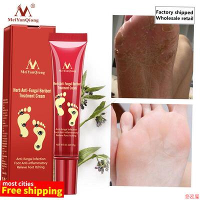 Herbal Effective Foot Cream Treatment Anti Fungal Infection