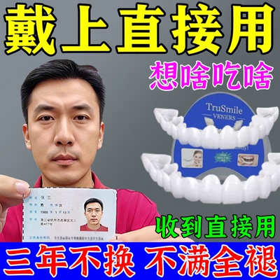 牙套通用吃饭神器成老年人成人通用遮丑全口塞防缺牙临时牙套大王