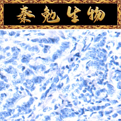 KleanABGAPDH兔多克隆抗体