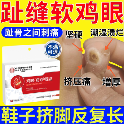 药监备案脚趾缝软鸡眼足部去除脚钉老茧肉刺瘊子祛跖疣贴可搭膏RW
