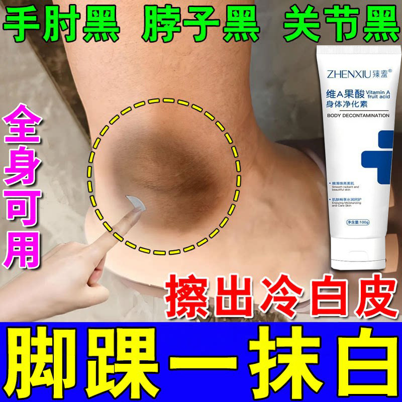维A果酸身体净化素改善腋下手肘膝盖脖子关节暗沉粗糙干燥鸡皮