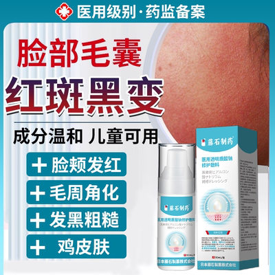 脸上起小疙瘩红斑黑变儿童可用