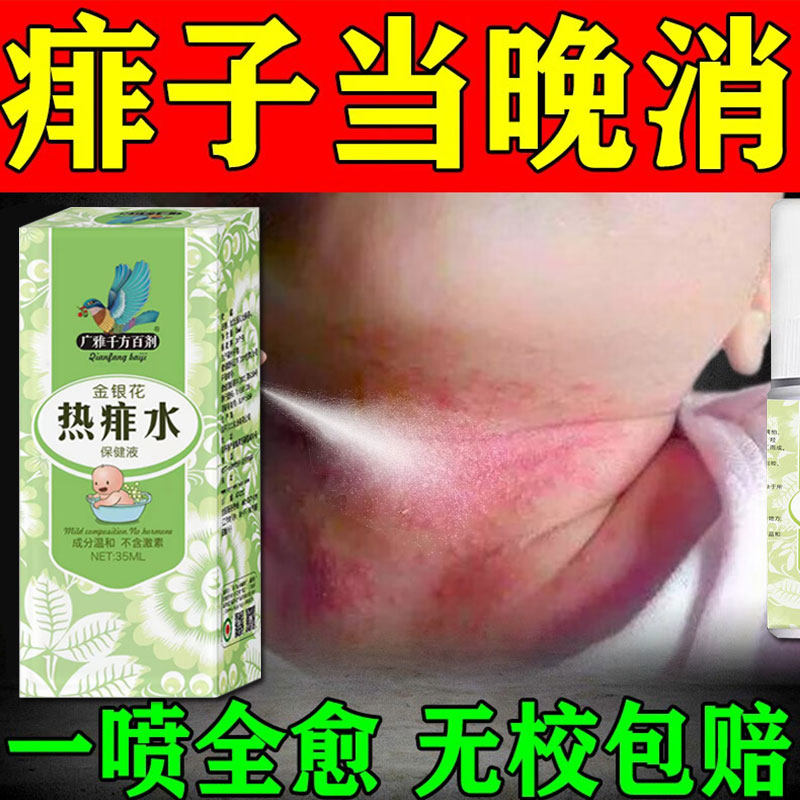 脖子出汗痒太阳晒痒疼成人热毒疹痒皮肤痱子止痒膏身上起热疙瘩痒