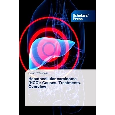 预订 Hepatocellular carcinoma (HCC): Causes. Treatments. Overview 肝细胞癌：病因。治疗方法。概述: 9786206774617