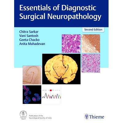 预订 Essentials of Diagnostic Surgical Neuropathology 诊断外科神经病理学要点: 9789395390057