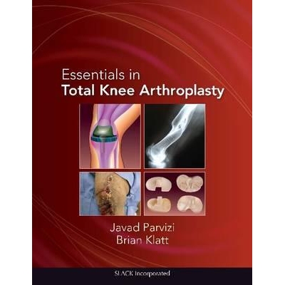 预订 Essentials in Total Knee Arthroplasty 全膝关节置换术要点 9781556428517