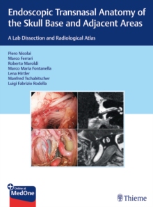 【预订】Endoscopic Transnasal Anatomy of the Skull Base and Adjacent Areas 9783132415621