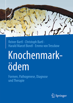 预订 Knochenmarködem
