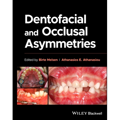 预订 Dentofacial and Occlusal Asymmetries 牙齿不对称: 9781119794813