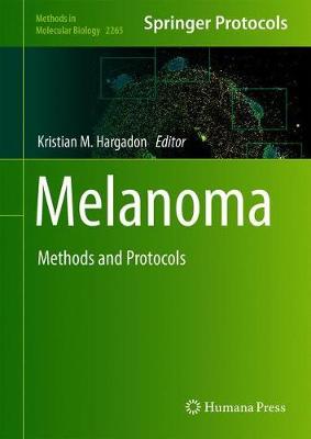 【预订】Melanoma
