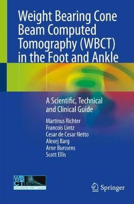 【预订】Weight Bearing Cone Beam Computed Tomography (WBCT) in the Foot and Ankle