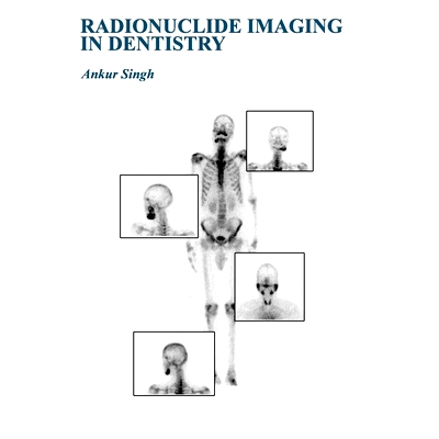 预订 Radionuclide Imaging in Dentistry: 9798481234472