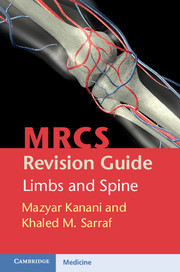 【预订】MRCS Revision Guide