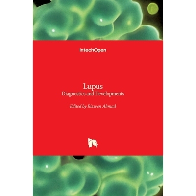 预订 Lupus  Diagnostics and Developments 狼疮诊断与发展: 9780854668182