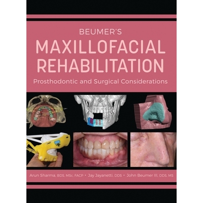 预订 Beumer’s Maxillofacial Rehabilitation: Prosthodontics and Surgical Considerations: 9781495619755