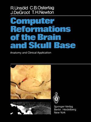 【预订】Computer Reformations of the Brain and Skull Base