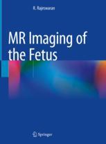 【预订】MR Imaging of the Fetus 9789811692086