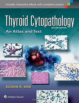 【预订】Thyroid Cytopathology