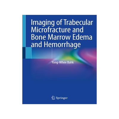 [预订]Imaging of Trabecular Microfracture and Bone Marrow Edema and Hemorrhage 9789811544682