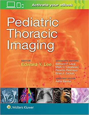 【预订】Pediatric Thoracic Imaging