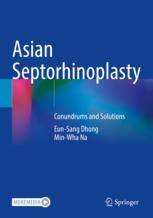 【预订】Asian Septorhinoplasty 9789811605444