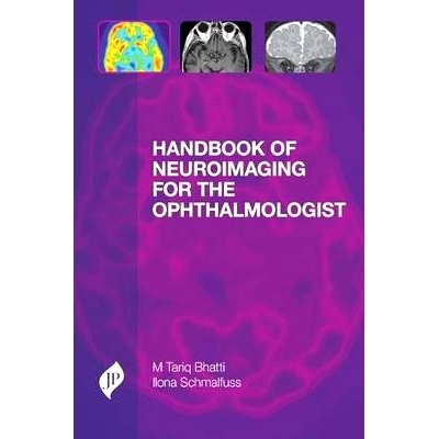 预订 Handbook of Neuroimaging for the Ophthalmologist: 9781907816130