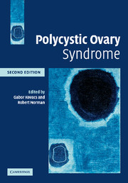 【预订】Polycystic Ovary Syndrome