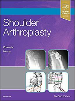 Shoulder Arthroplasty 肩关节置换术