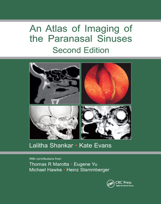 【预订】An Atlas of Imaging of the Paranasal Sinuses