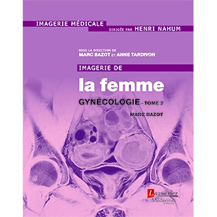 预订 Imagerie de la femme. Vol. 3. Gynécologie. Vol. 2 女性形象。航班。 3.妇科。航班。 2: 9782257206060