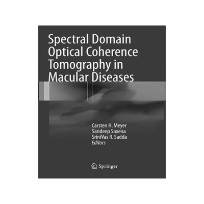 预订 Spectral Domain Optical Coherence Tomography in Macular Diseases