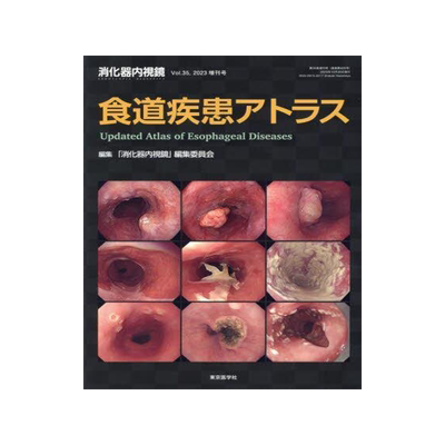 [预订]消化器内視鏡 Vol.35増刊号(2023) 9784885636783