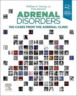 【预订】Adrenal Disorders: 100 Cases from the Adrenal Clinic 9780323792851