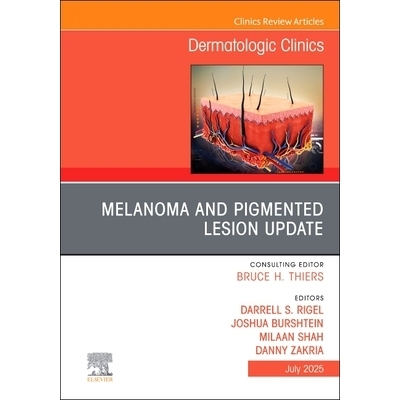 预订 Melanoma and Pigmented Lesion Update, An Issue of Dermatologic Clinics: Volume 43-3 黑色素瘤和色素性病变*进展，《皮