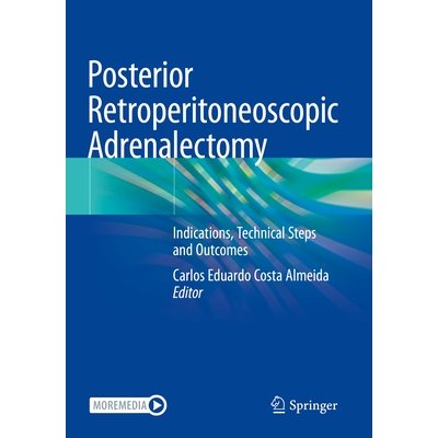 预订 Posterior Retroperitoneoscopic Adrenalectomy Indications, Technical Steps and Outcomes 后腹腔镜肾上腺切除术：适应症