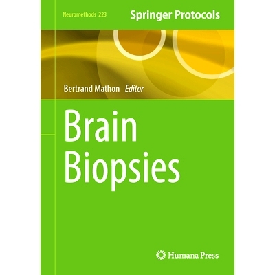 预订 Brain Biopsies 脑活检: 9781071645130