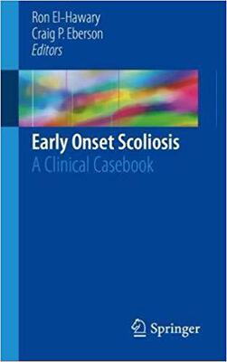 【预售】Early Onset Scoliosis