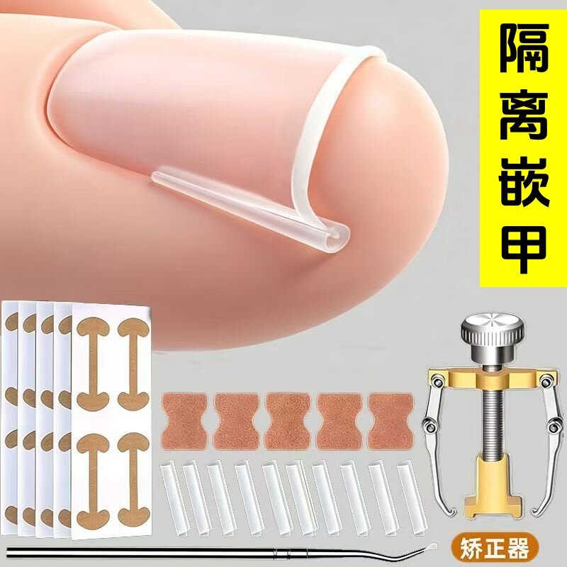甲沟矫正器嵌甲美甲修甲专用矫正神器脚沟指甲矫正填充贴片套装