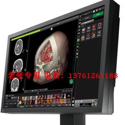 艺卓EIZORX850医疗液晶显示器