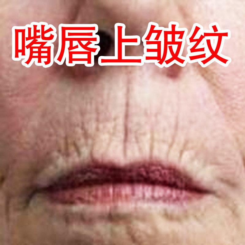 草本嘴唇皱纹精油 唇纹人中纹人中精华液眼纹抬头纹川字纹周口纹