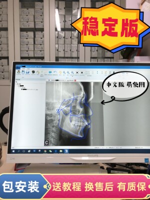 uceph中文稳定版4.2.1加密狗头影测量牙科正畸软件送教程包安装