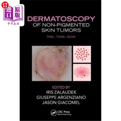 海外直订医药图书Dermatoscopy of Non-Pigmented Skin Tumors: Pink-Think-Blink 非色素性皮肤肿瘤的皮肤镜检查：粉红色