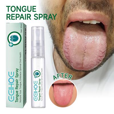 EELHOE Tongue Repair Spray: A restorative spray for whitish