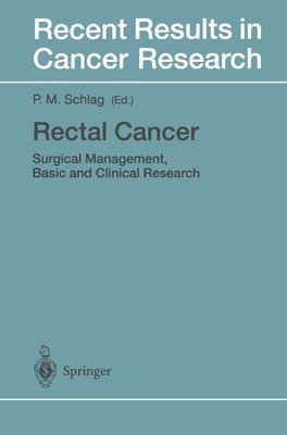 【预订】Rectal Cancer: Surgical Management, ...