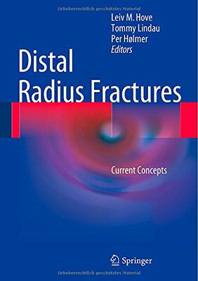 【预订】Distal Radius Fractures