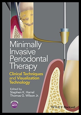 【预售】天猫正版：Minimally Invasive Peri