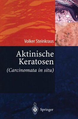 【预订】Aktinische Keratosen (Carcinomata in Situ)