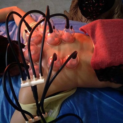 碧波家庭配件养生仪器分流阀拔罐杯四六通开关阀门长短软管调压阀