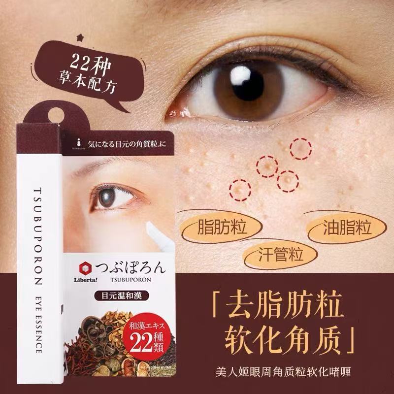 去脂肪粒神器日本本土美人姬himecoto脂肪粒角质粒小肉粒啫喱质地