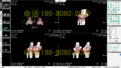 CT工作站，DR软件，放射PACS